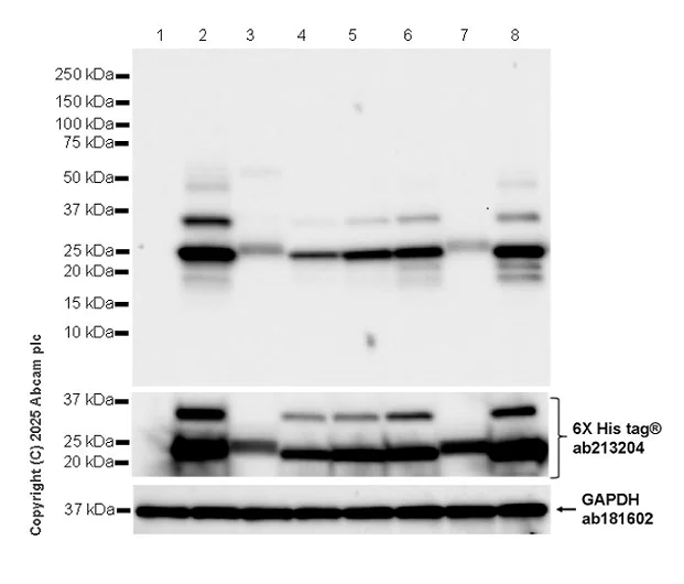 Anti-Hepatitis B Virus Core Antigen antibody [EPR29890-38] (ab323646 ...