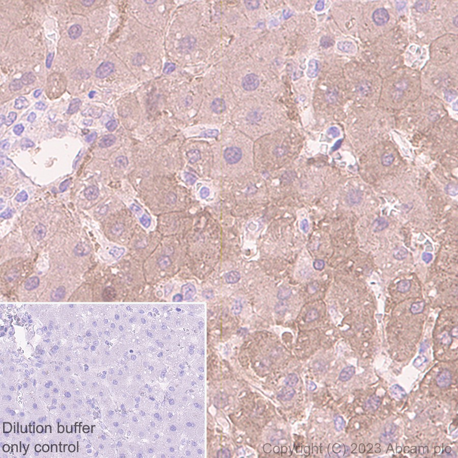 Anti-Hepsin/HPN antibody [EP7654] (ab189246) | Abcam