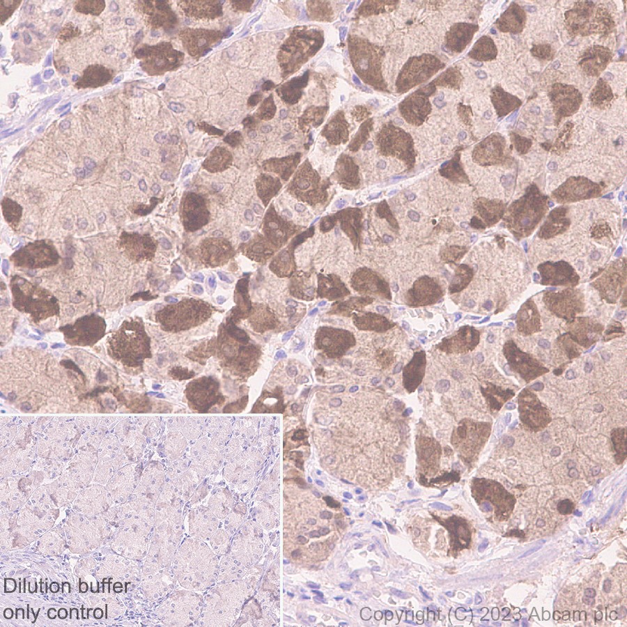 Anti-Hepsin/HPN antibody [EP7654] (ab189246) | Abcam