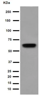 Anti-Hepsin/HPN antibody [EP7654] (ab189246) | Abcam