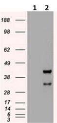 Anti-Hex antibody [OTI3E6] (ab117864) | Abcam