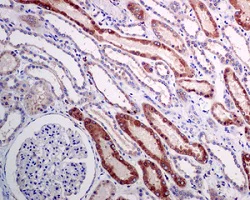 Anti-HEXB antibody [EPR7978] (ab140649) | Abcam