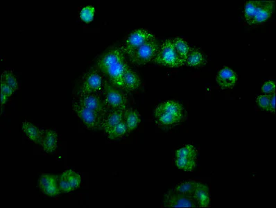 Anti-HEXO antibody (ab236945) | Abcam