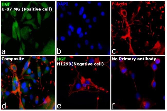 Anti-HGF Antibody [RP23040069] (ab313408) | Abcam