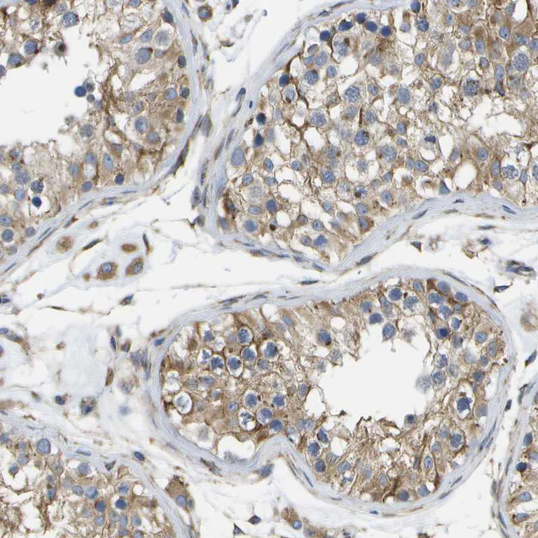 Anti-HIP14 antibody (ab253017) | Abcam