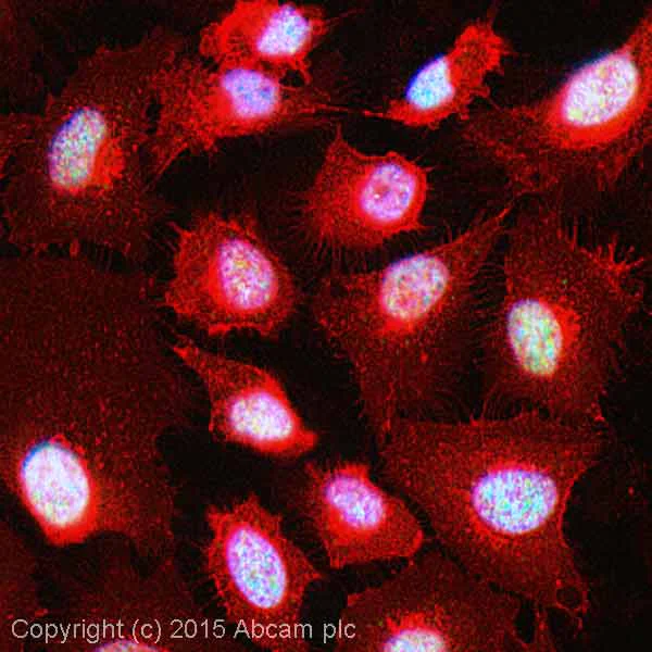 Histone H2A抗体- ChIP Grade (ab18255)| Abcam中文官网