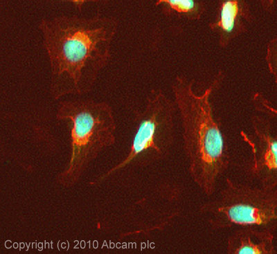 Anti-Histone H2A antibody - ChIP Grade (ab88770) | Abcam