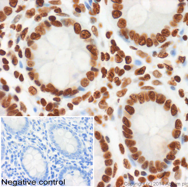 Anti-Histone H2A.X antibody - ChIP Grade (ab20669) | Abcam
