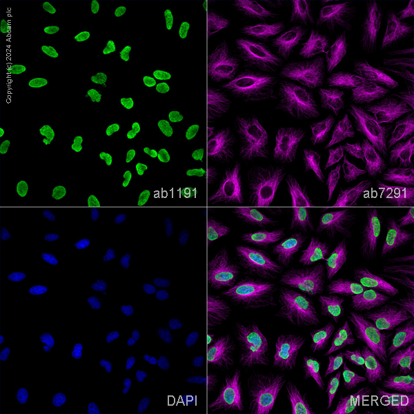 Anti-Histone H3 (acetyl K18) antibody - ChIP Grade (ab1191) | Abcam