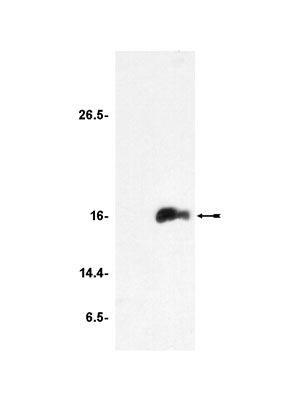 Anti-histone H3K9ac (Acetyl H3K9), ChIP grade (ab4441) | Abcam