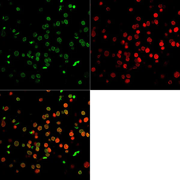 Anti-Histone H3 antibody - Nuclear Marker and ChIP Grade (ab1791) | Abcam