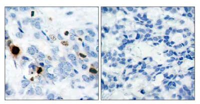 Anti-Histone H3 (phospho S10) antibody (ab47297) | Abcam