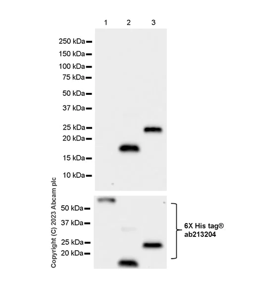 Anti-HIV1 p55 + p24 +p17 antibody [RM2002] (ab309159) | Abcam
