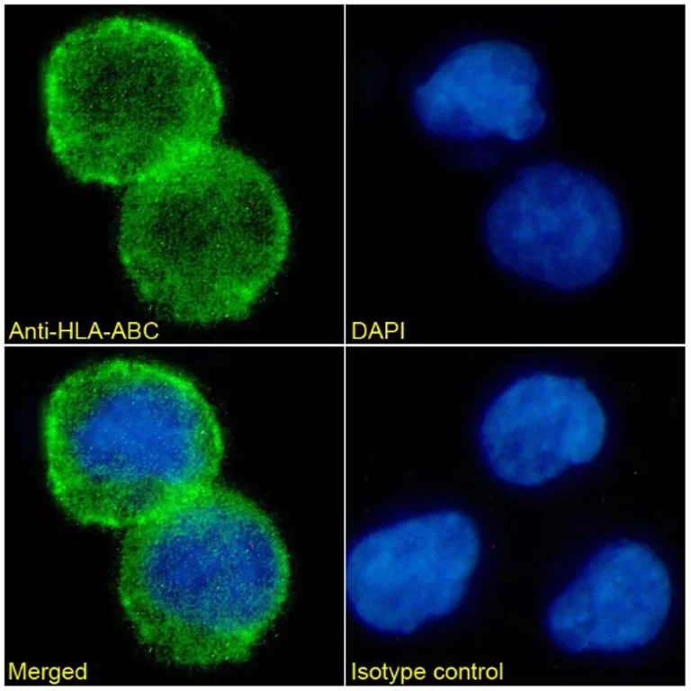 Anti-HLA-ABC Antibody [Bu8] (ab316357) | Abcam