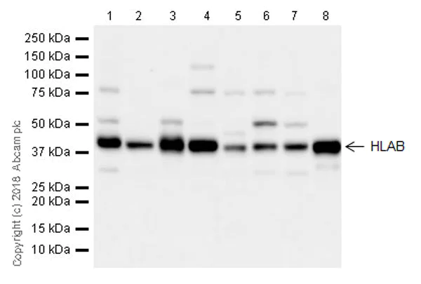 HLA Class 1 ABC抗体[EPR22172] (ab225636)| Abcam中文官网