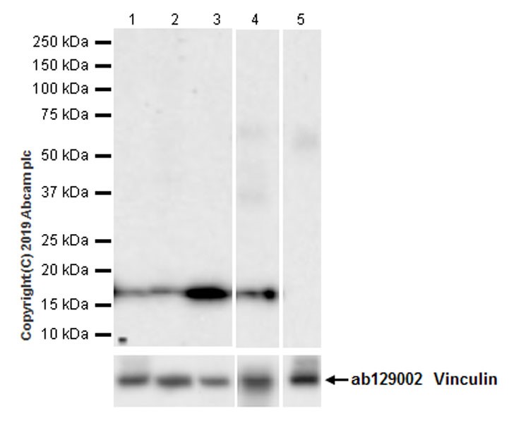 Anti-HMGA1 antibody [EPR22421-101] - ChIP Grade (ab252930) | Abcam