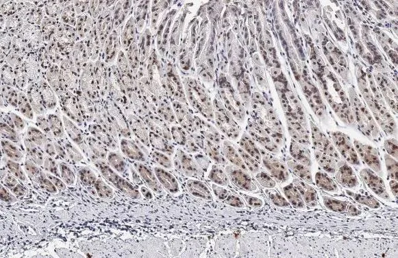 Anti-HMGA2 antibody [HL1936] - BSA and Azide free (ab308208) | Abcam