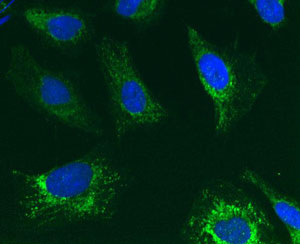Anti-HMGCL antibody [9F5AB9] (ab110295) | Abcam