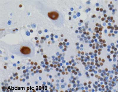 Anti-hnRNP U/p120 antibody [3G6] (ab10297) | Abcam