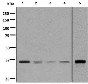Anti-HOXA9 antibody [EPR3655(2)] (ab140631) | Abcam