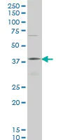 Anti-HOXD11 antibody [5G4] (ab55255) | Abcam