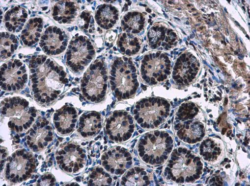 Anti-HP1 gamma/CBX3 antibody (ab227478) | Abcam