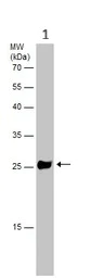 Anti-HPRT antibody (ab97698) | Abcam