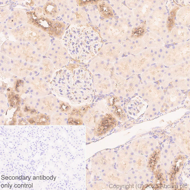 Anti-HPS1 antibody [EP8429(2)] - BSA and Azide free (ab284824) | Abcam