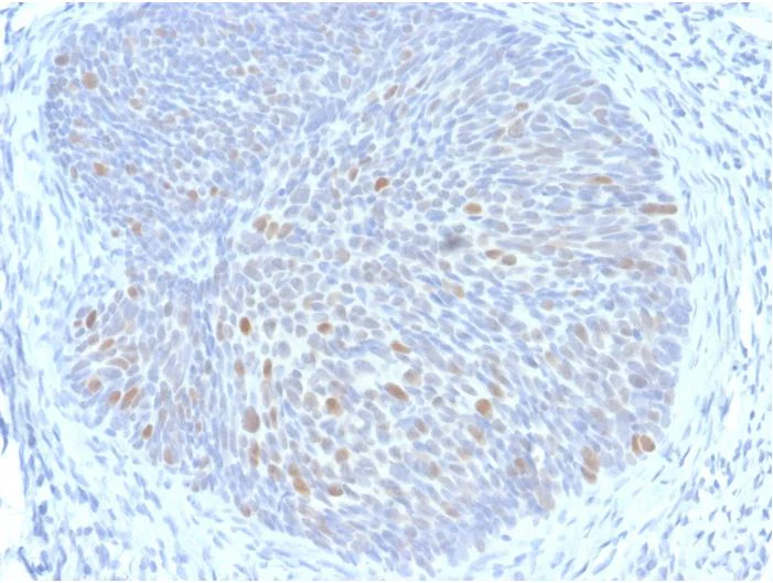 Anti-HPV16 E1+E4 antibody [HPV16 E1/E4] (ab270738) | Abcam