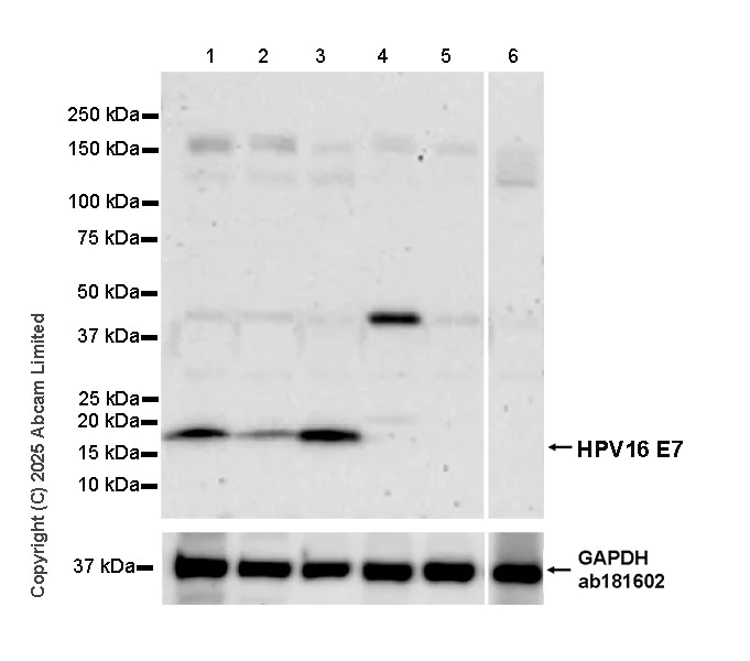 Anti-HPV16 E7 antibody [EPR30642-21] (ab325396) | Abcam中文官网