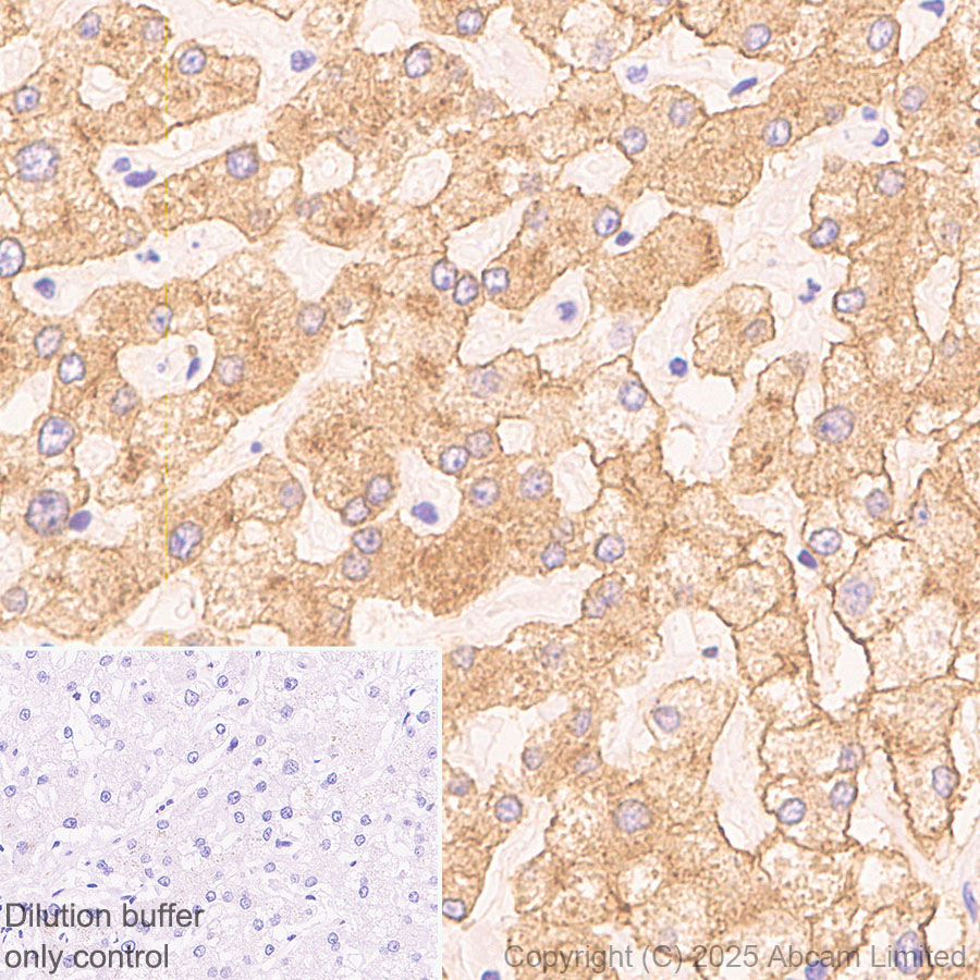 HRP Anti-Asialoglycoprotein Receptor 1/HL-1 antibody [EPR22642-17 ...