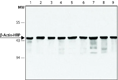 Anti-beta Actin HRP antibody [AC-15] (ab49900) IgG1 | Abcam