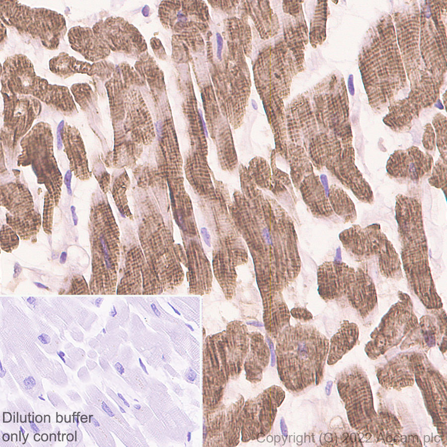HRP Anti-Cardiac Troponin I antibody [EP1106Y] (ab305816) | Abcam