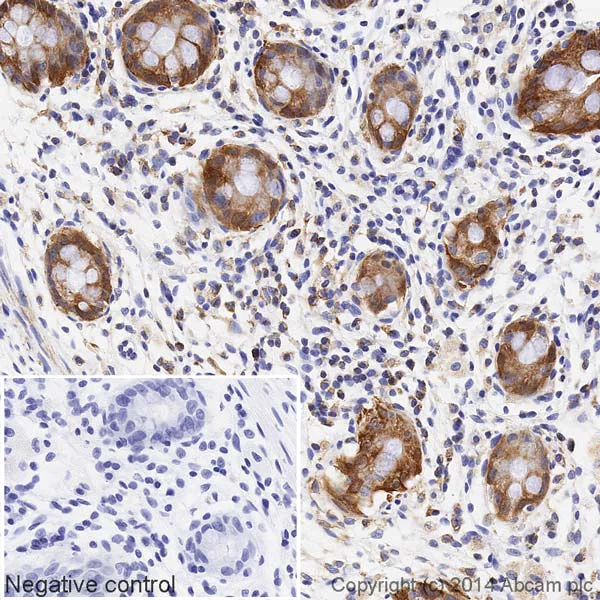Anti-Cytochrome C HRP antibody [37BA11] (ab198489) IgG2a | Abcam