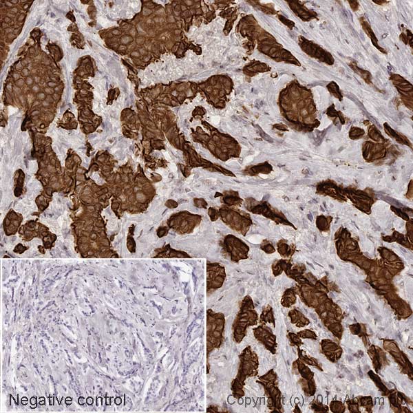 HRP Anti-Cytokeratin 8 antibody [EP1628Y] (ab193094) | Abcam