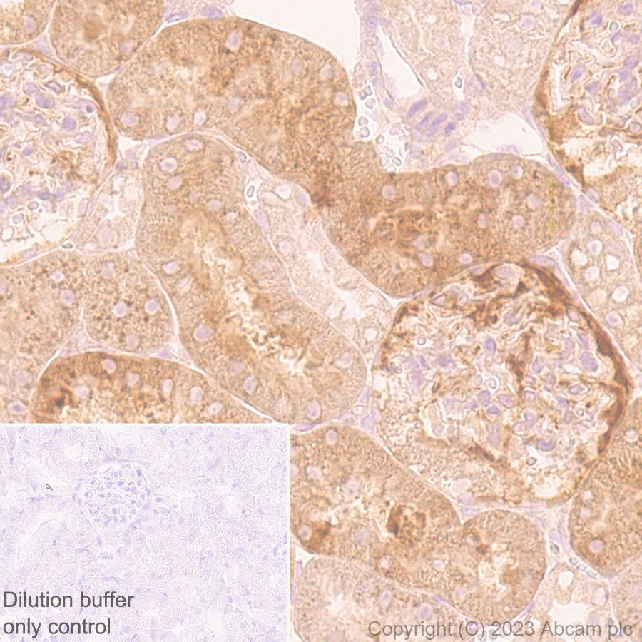 HRP Anti-Ferritin Heavy Chain antibody [EPR18878] (ab314244) | Abcam