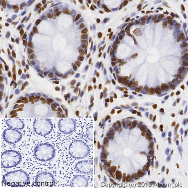Anti-Histone H2B HRP antibody [mAbcam 52484] (ab204463) IgG1 | Abcam