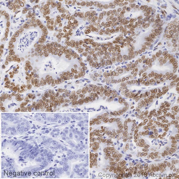 Anti-Lamin A + Lamin C HRP antibody [EPR4100] (ab193904) IgG | Abcam