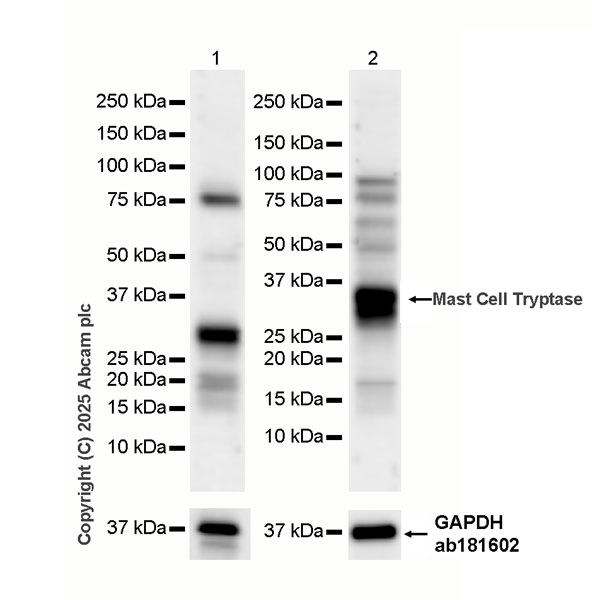 HRP Anti-Mast Cell Tryptase antibody [EPR9522] (ab323662) | Abcam