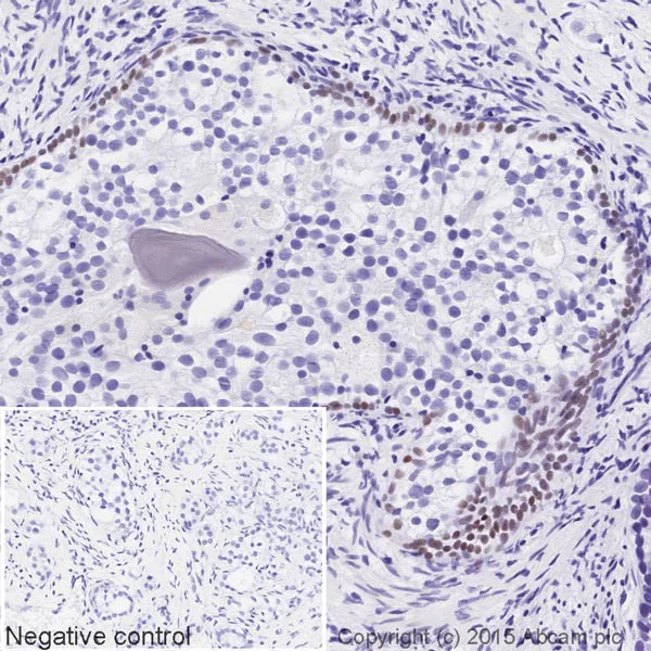 HRP Anti-p63 antibody [EPR5701] (ab202357) | Abcam