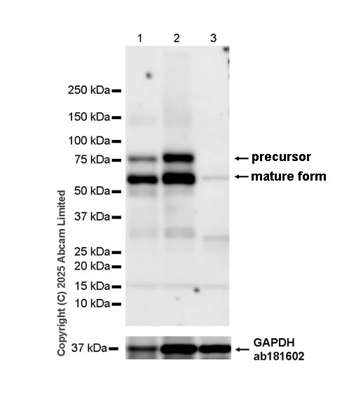 HRP Anti-PCSK9 antibody [EPR7627(2)] (ab323661) | Abcam
