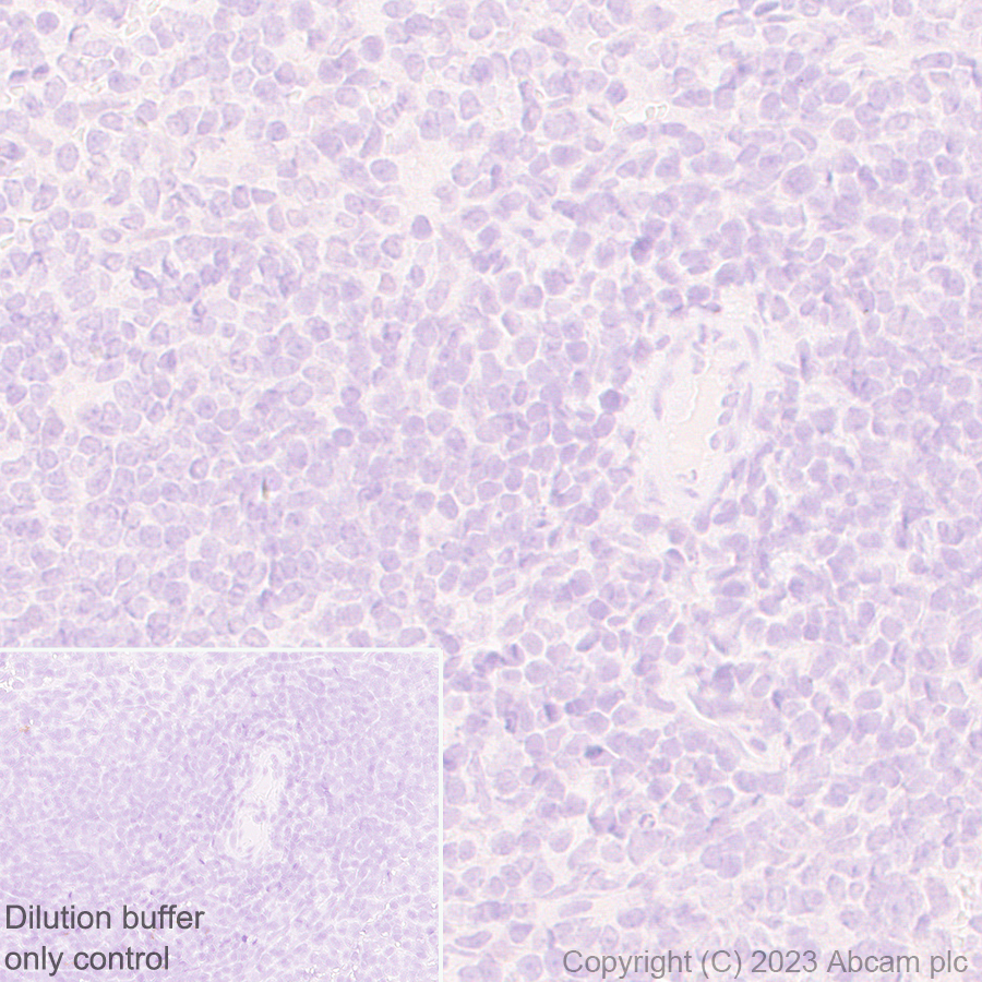 HRP Anti-Prosurfactant Protein C antibody [EPR19839] (ab314245) | Abcam