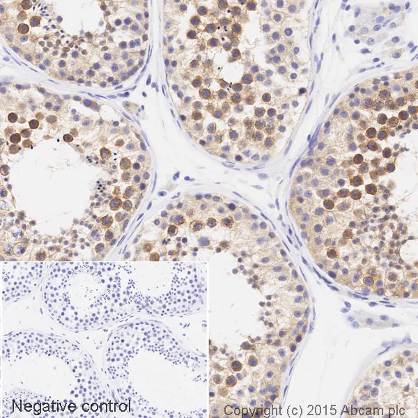 HRP Anti-RENT1/hUPF1 antibody [EPR4681] (ab201818) | Abcam