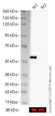Anti-SQSTM1 / p62 HRP antibody [EPR4844] (ab194720) IgG | Abcam