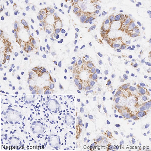 Ubiquinol-Cytochrome C Reductase Core Protein I抗体 (ab96333)| Abcam中文官网