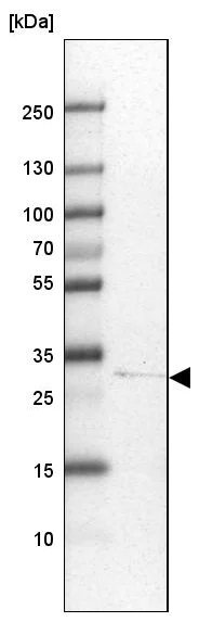 Anti-Hsd17b11 antibody (ab224437) | Abcam
