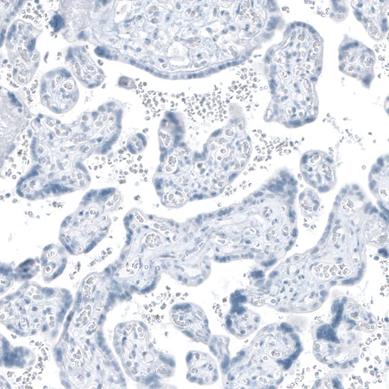 Anti-HSD17B13 antibody. Rabbit polyclonal (ab122036) | Abcam