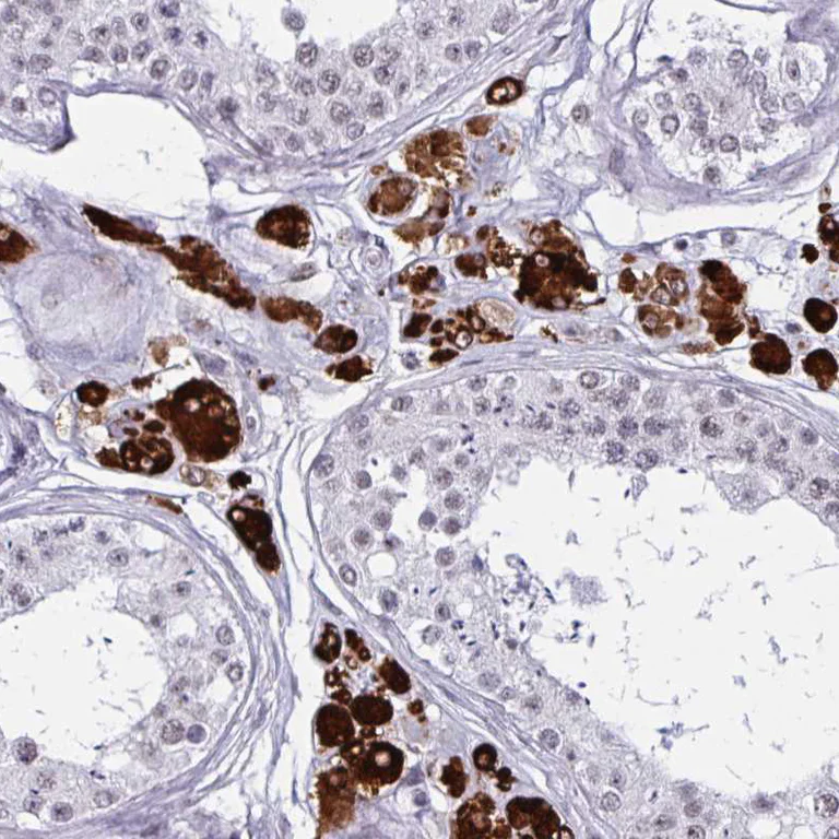 Anti-HSD17B6 antibody (ab272668) | Abcam