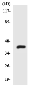 Anti-HSD3B7 antibody (ab136846) | Abcam