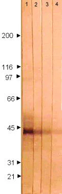 HSV1 gG Envelope Protein抗体[7F5] (ab6511)| Abcam中文官网